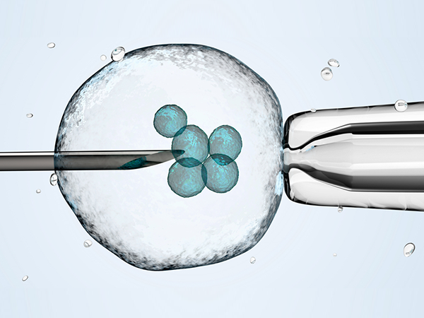 IVF , Basics